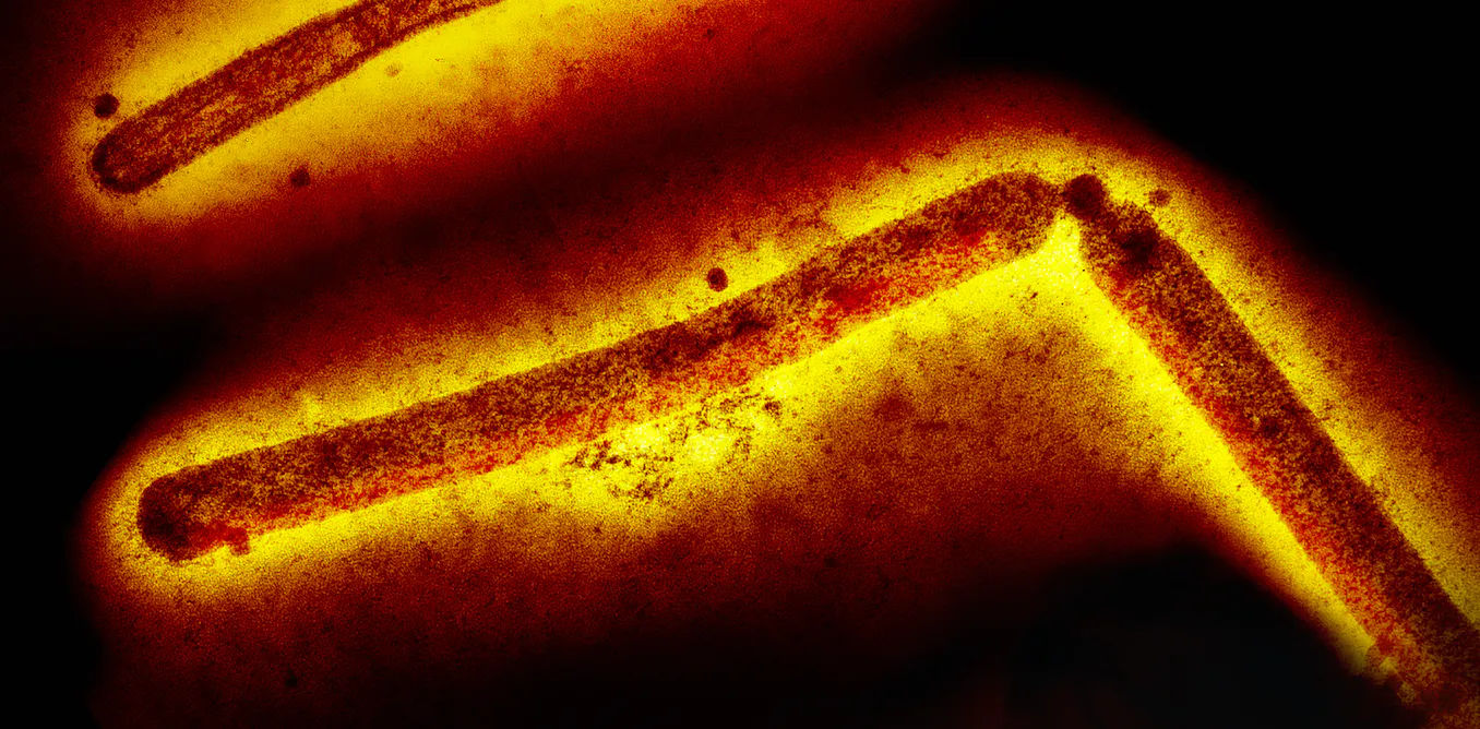 Bird flu FAQ: What is avian influenza? How is it transmitted to humans ...