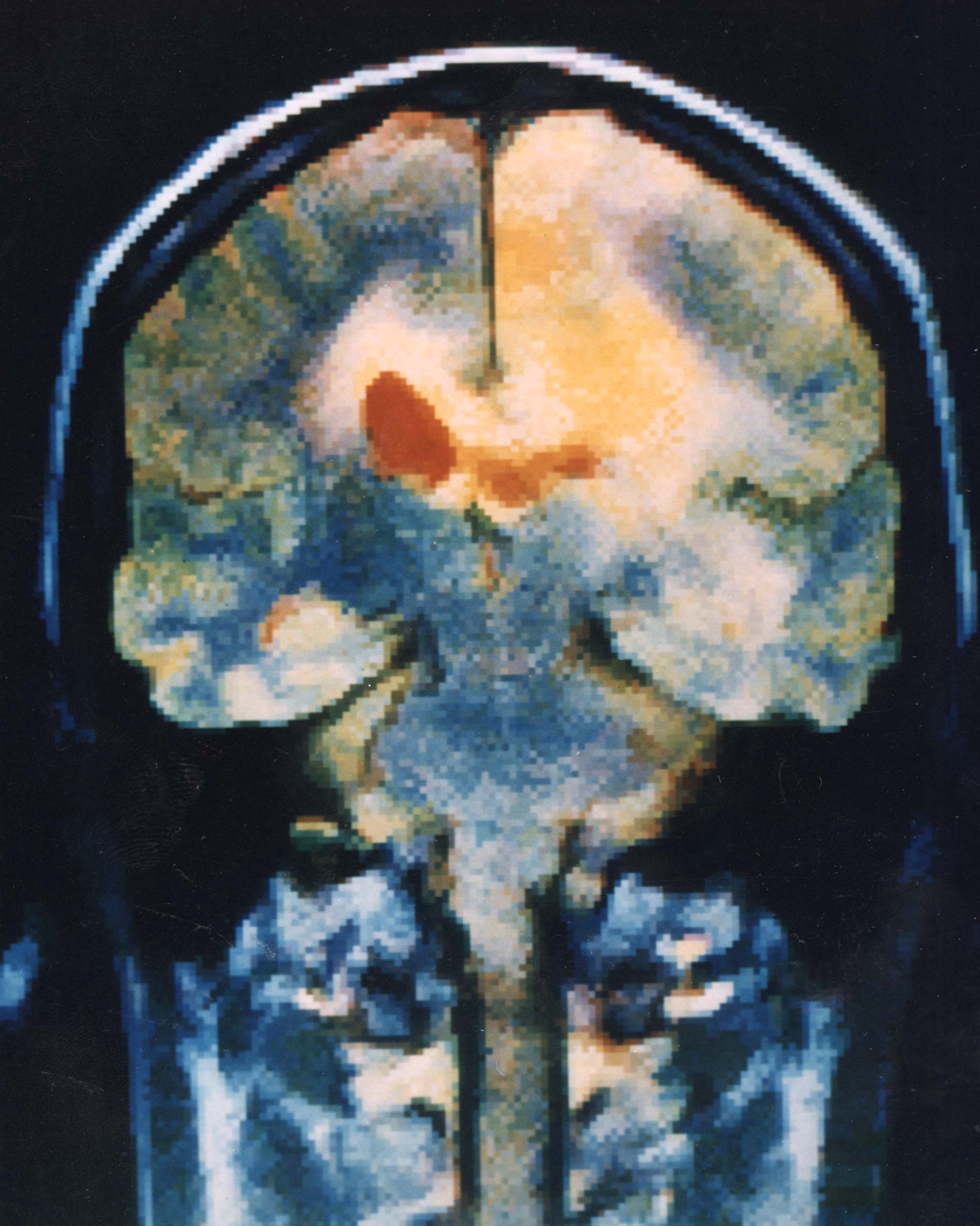 What Can AI Decode From Human Brain Activity? | The-14 What Can AI Decode From Human Brain Activity? | The-14