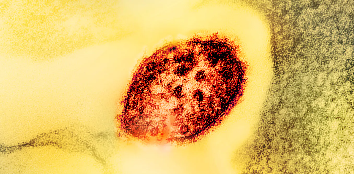 Measles is highly contagious, but vaccine-preventable: A primer on ...